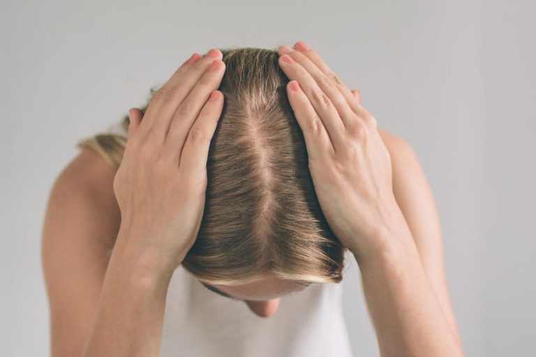 How to Soothe Bleach Burns on the Scalp & Why it Happens